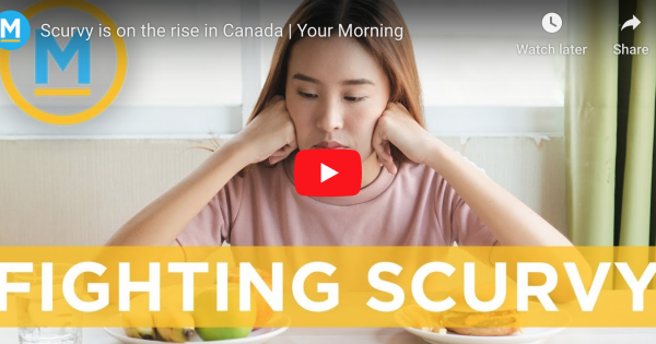 Scurvy is on the Rise in Canada – The Vaccine Reaction